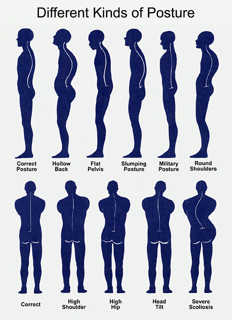 Benefits Of A Good Posture And 13 Tips To Get One Personal Excellence